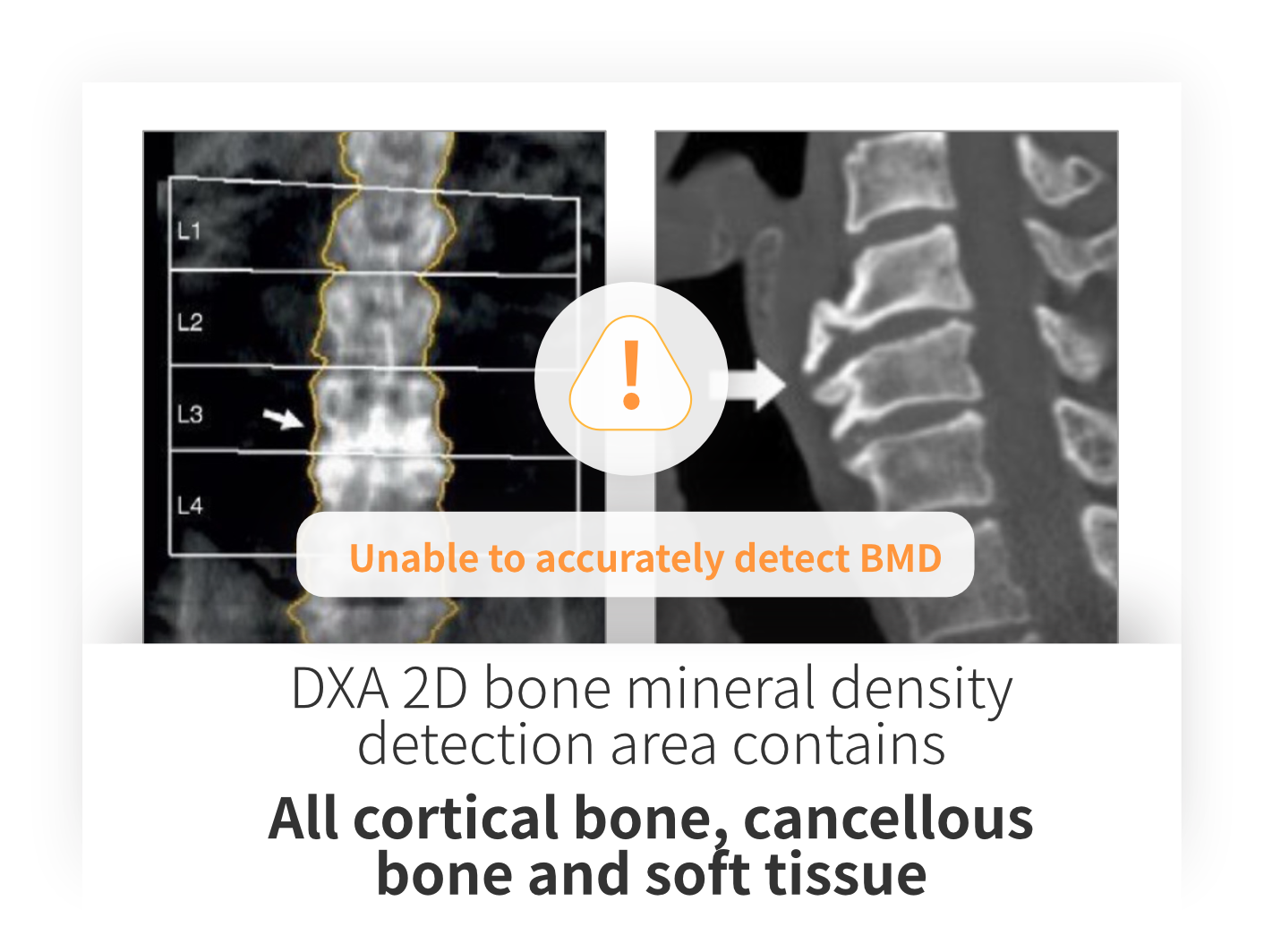 Bonestech - About Bonestech