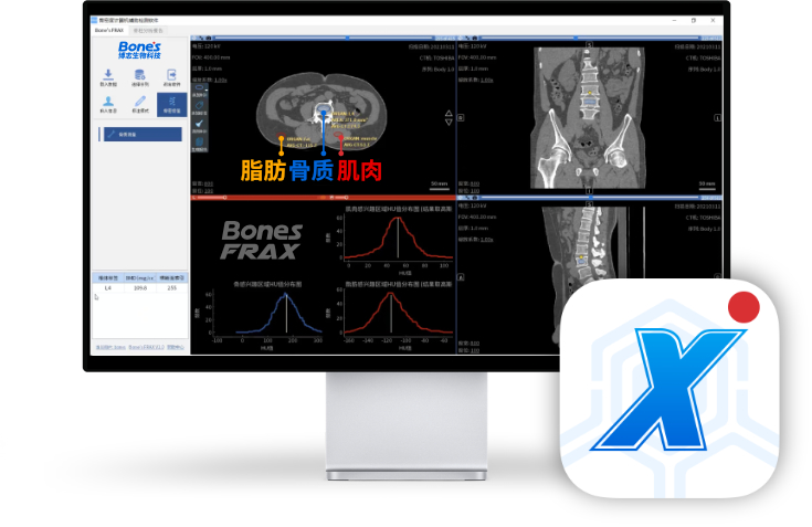 博志生物科技 - 成为骨科智能器械全球行业领导企业